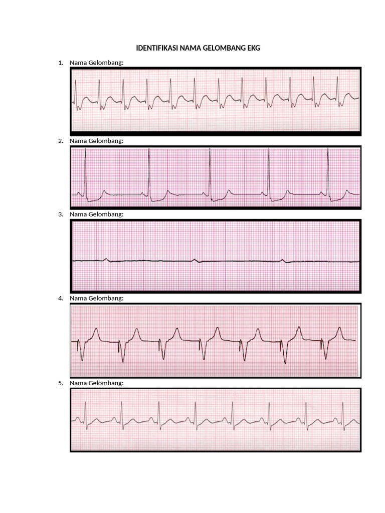 Identifikasi Gelombang Ekg (Mahasiswa) | PDF | Ilmu Sosial | Sains ...