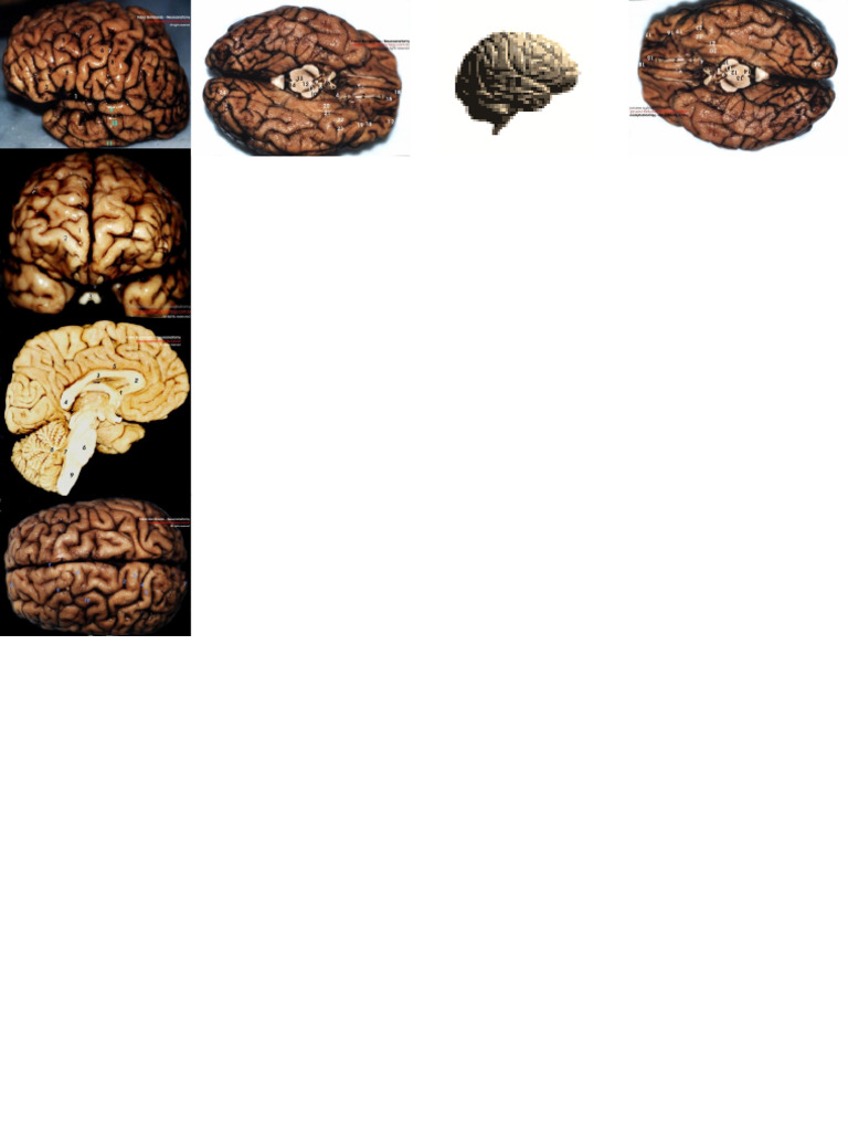 Aula 3 - Tronco Encefálico | PDF | Órgão (anatomia) | Anatomia humana