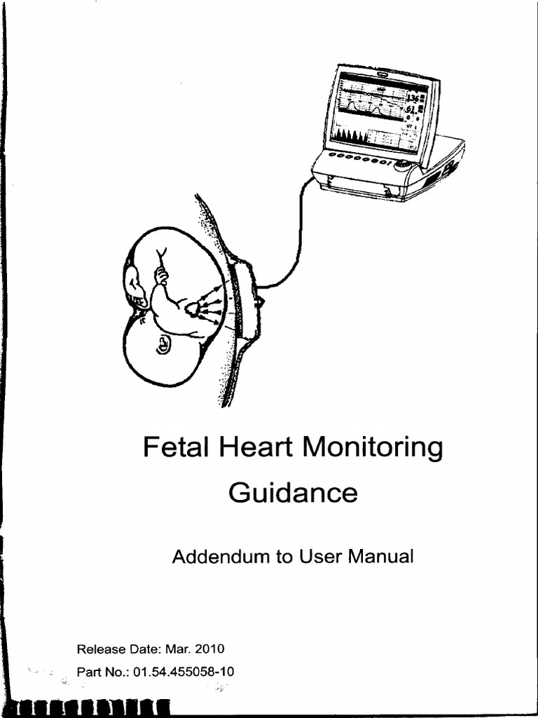 Fetal Heart Monitoring User Manual | PDF
