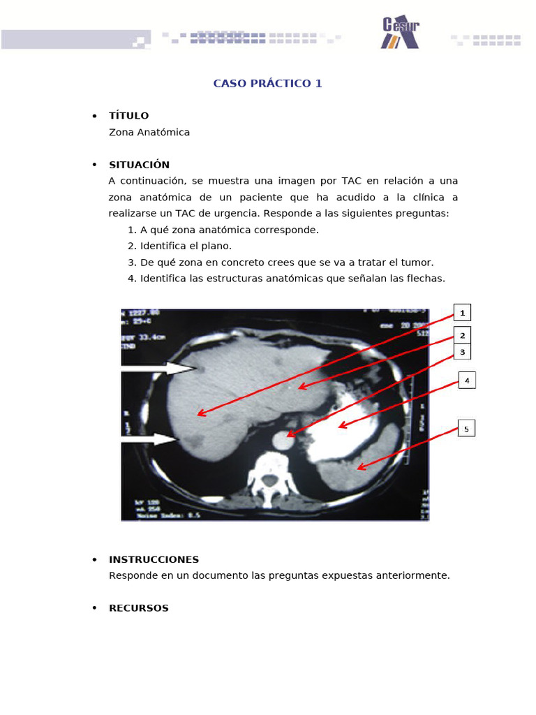 Caso 1 UD6 | PDF | Informática