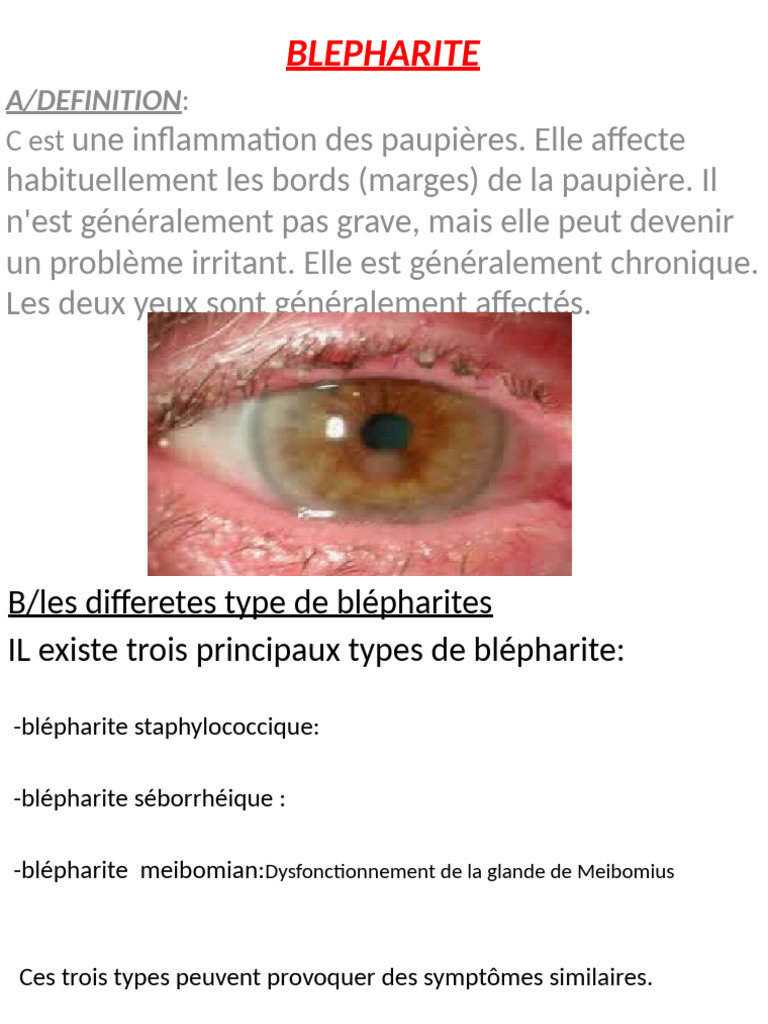 Types et traitement de la blépharite | PDF | Maladies et troubles ...