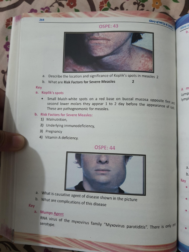 Ospe From Book | PDF