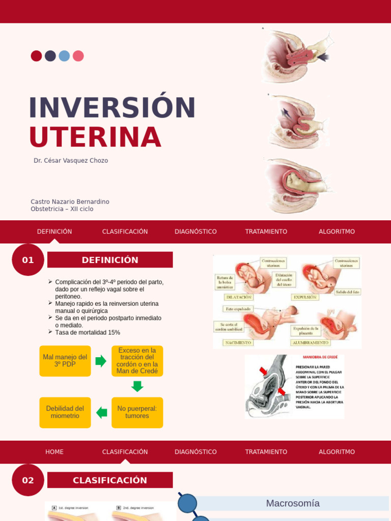 Inversion Uterina | PDF | Parto | Útero