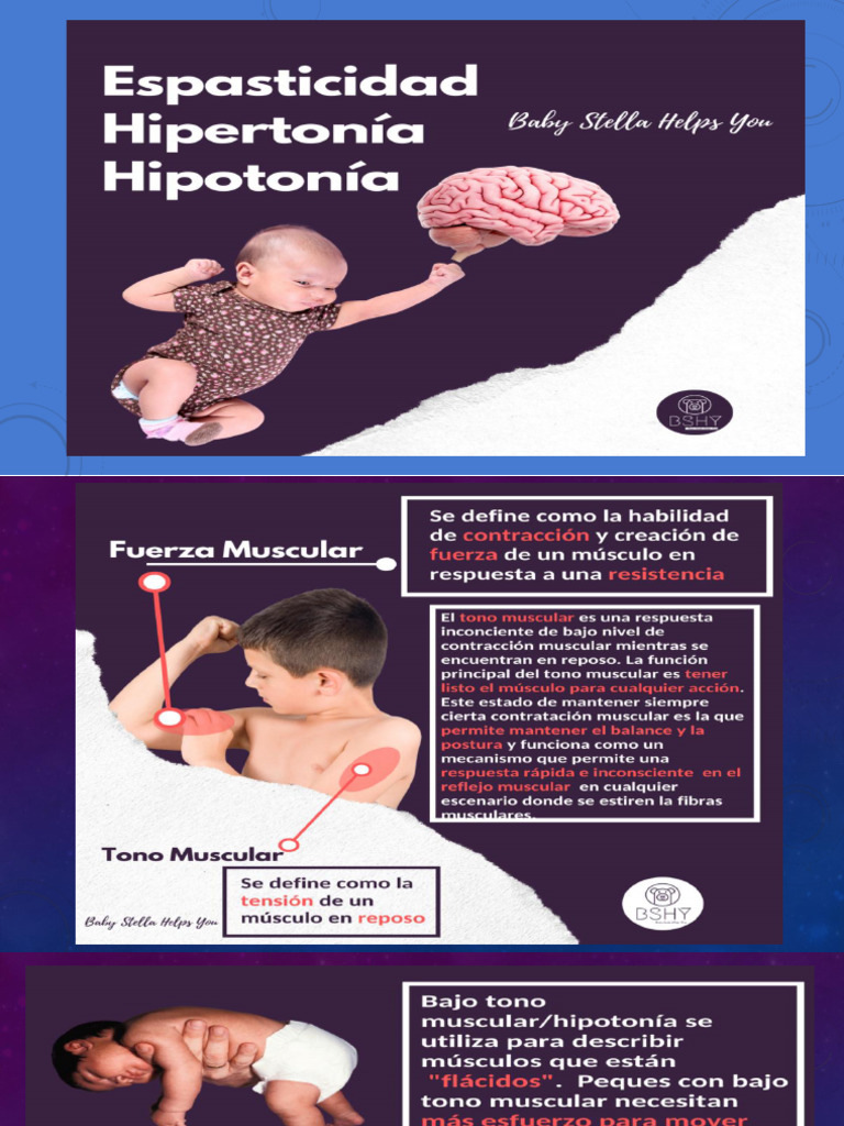 U3 - Presentación Tono, Hiper, Hipo | PDF