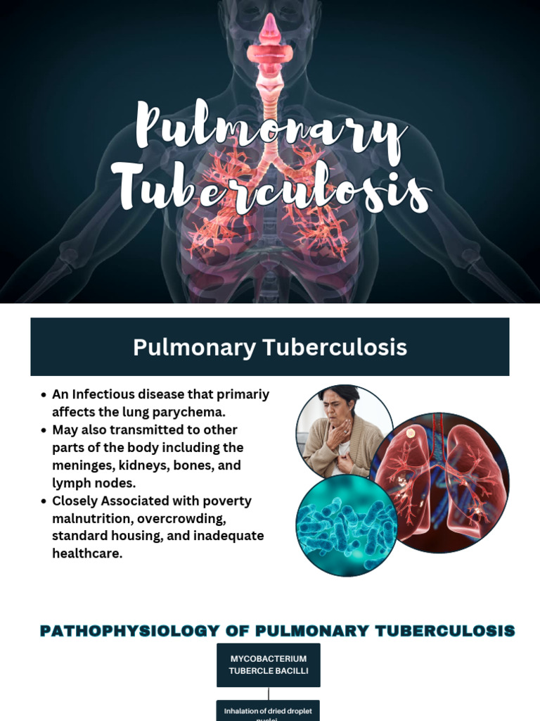 Pulmonary Tuberculosisfinal | PDF | Tuberculosis | Diseases And Disorders