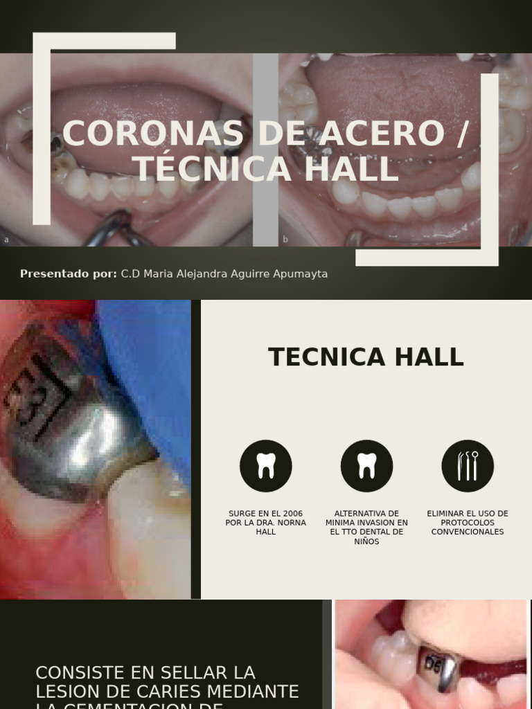 Coronas de Acero | PDF | Ramas de Odontología | Medicina