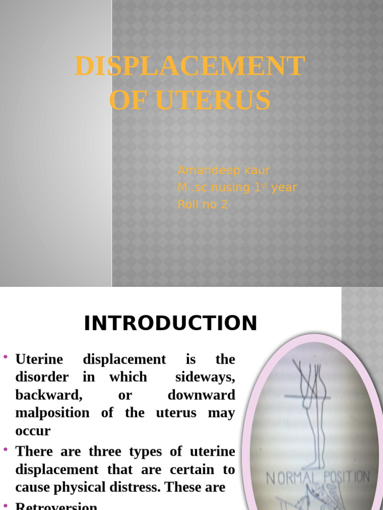 Uterine Displacement and Prolapse Overview | PDF | Uterus | Vagina