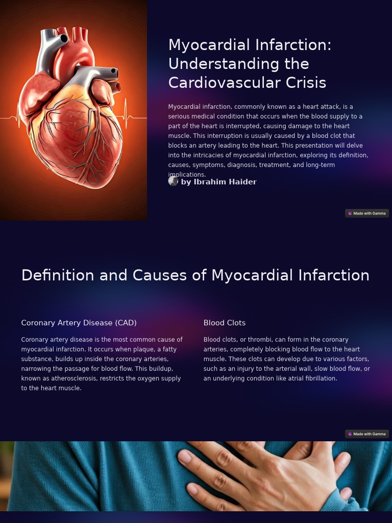 Myocardial Infarction Overview | PDF | Myocardial Infarction | Heart
