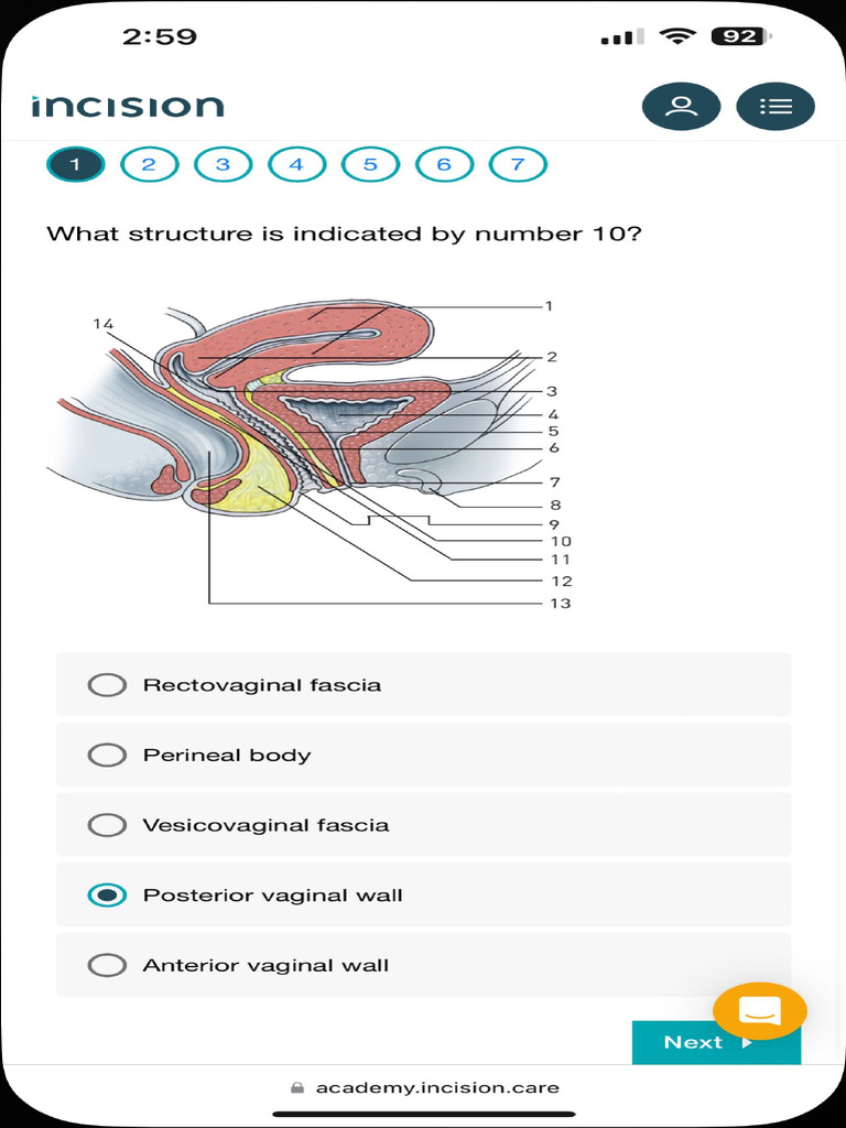OBGYN - Mediolateral Episiotomy | PDF
