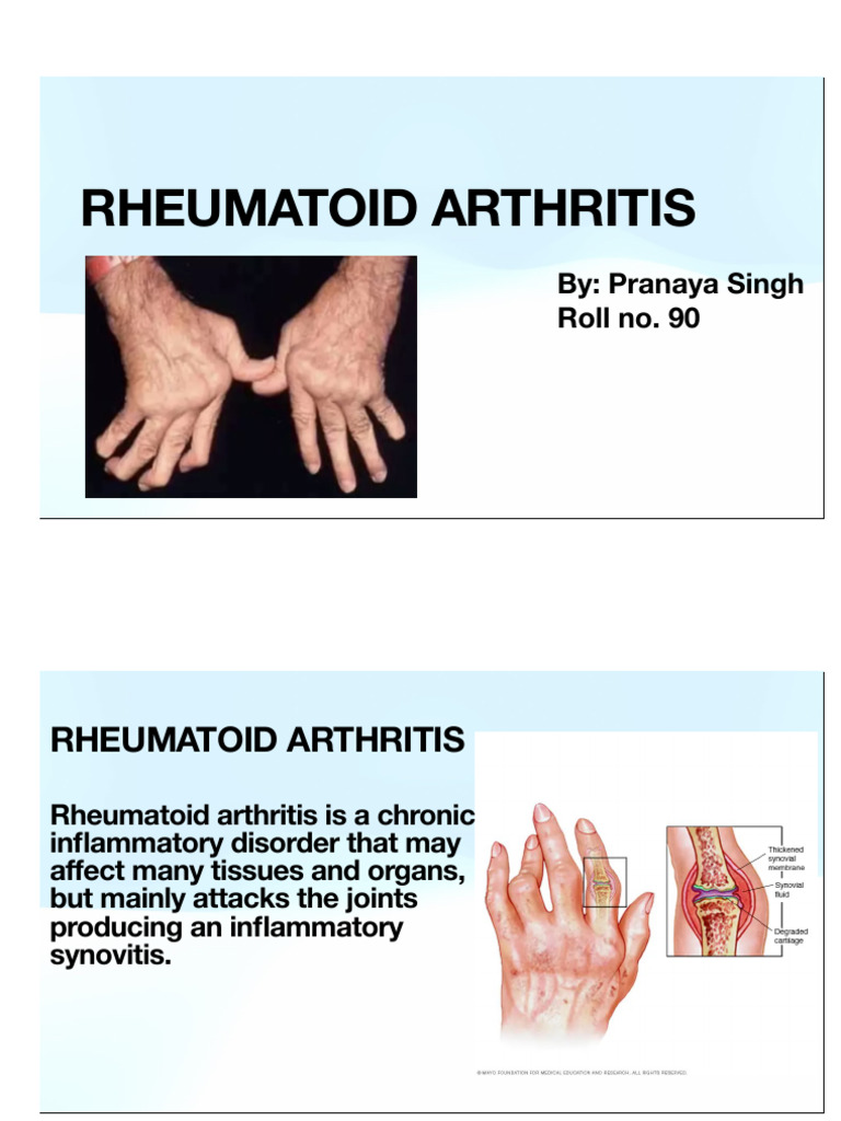 Rheumatoid Arthritis | PDF | Wellness
