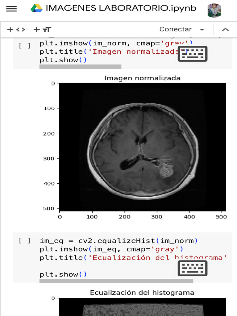 Imagenes Laboratorio - Ipynb - Colaboratory | PDF