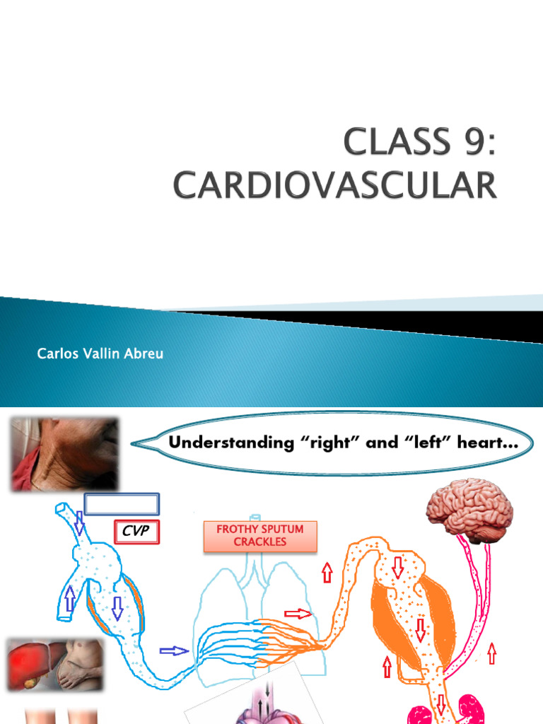class 9 CV | PDF | Cardiopulmonary Resuscitation | Myocardial Infarction