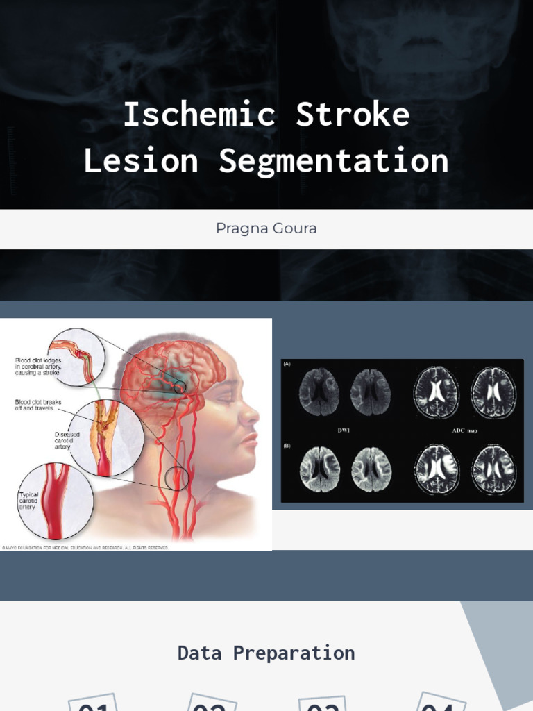 Ischemic Stroke Lesion Segmentation Pdf
