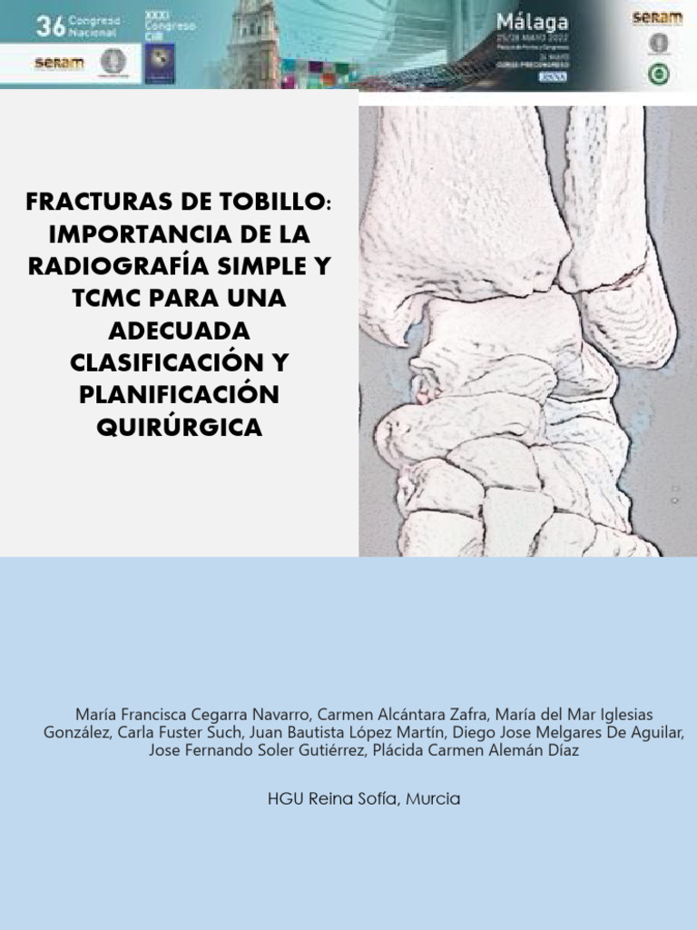 Fracturas de Tobillo: RX y TC | PDF | Tobillo | Sistema musculoesquelético