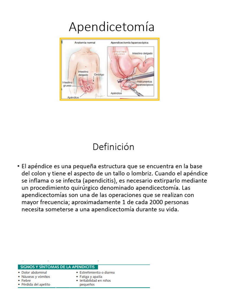 Apendicectomía: Tipos y Diagnóstico | PDF | Especialidades Medicas ...