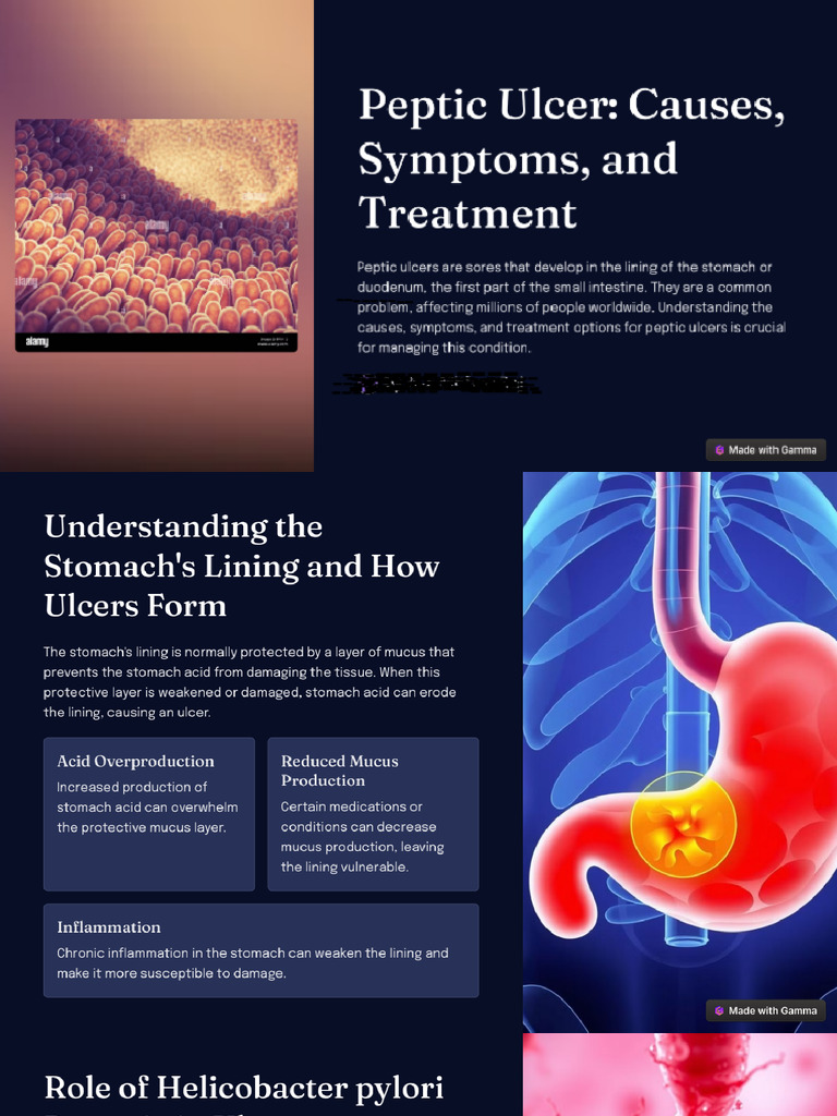 Peptic Ulcer | PDF