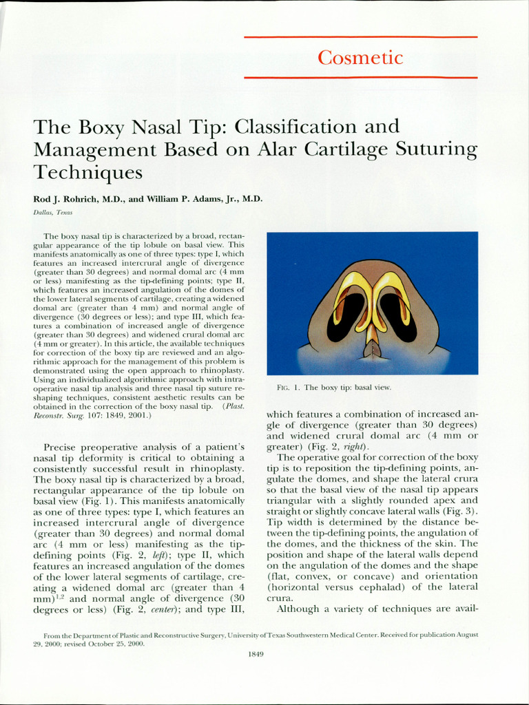 Addressing Boxy Nasal Tip Issues | PDF