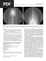 LifeStent Vascular Stent System Brochure (Bard) (BD Interventional ...