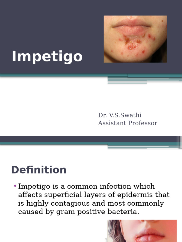 Impetigo 200219164811 | PDF | Staphylococcus | Medical Specialties
