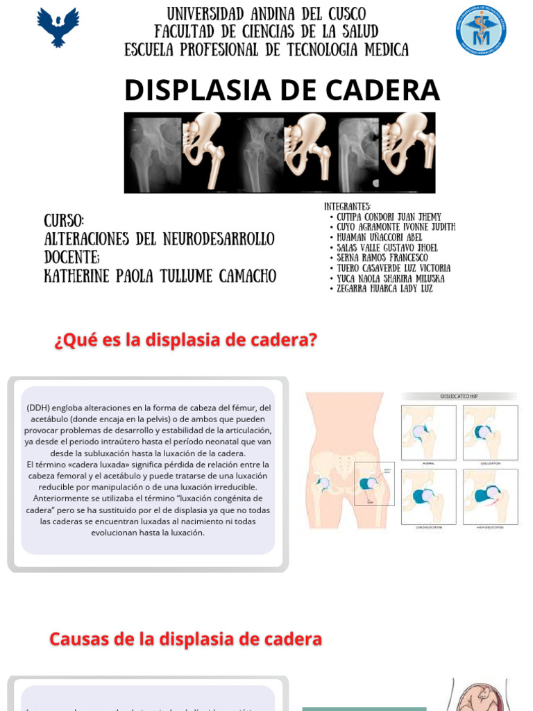 Displasia De Cadera Grupo 2 Pdf El Embarazo Parto