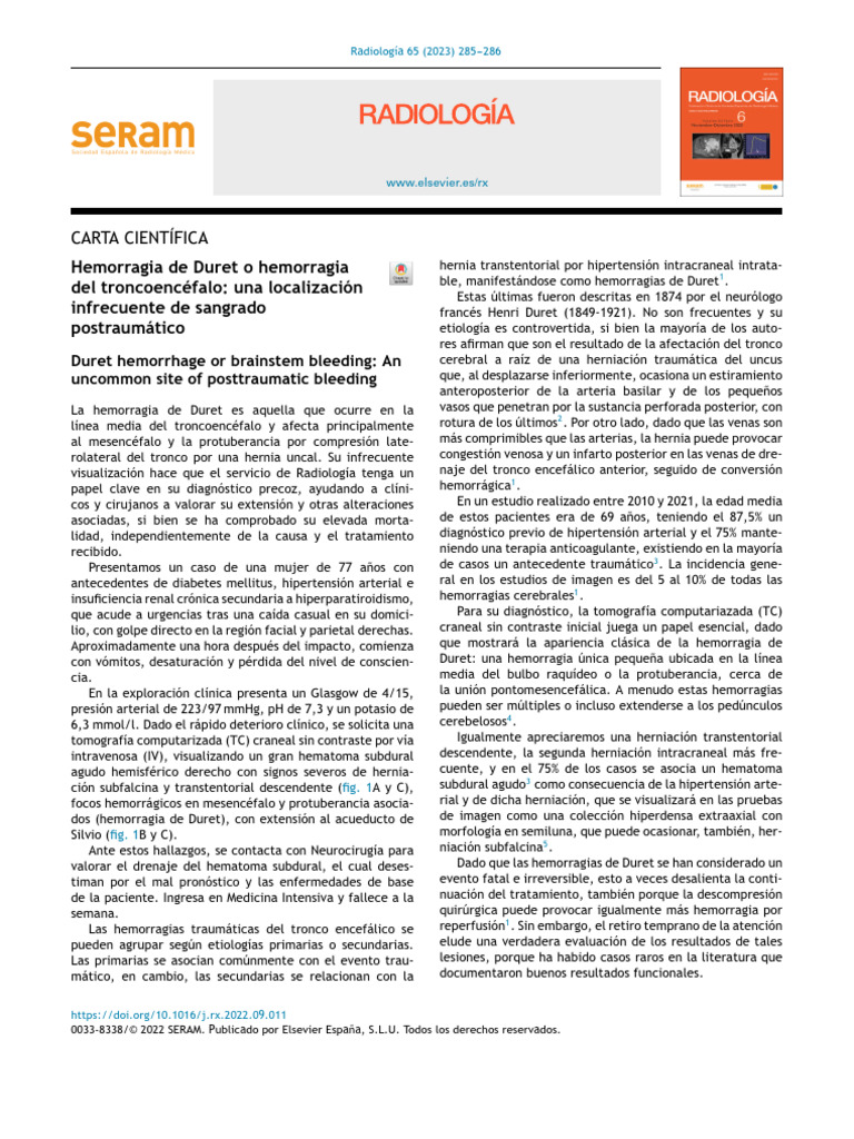 Duret | PDF | Hipertensión | Enfermedades y trastornos