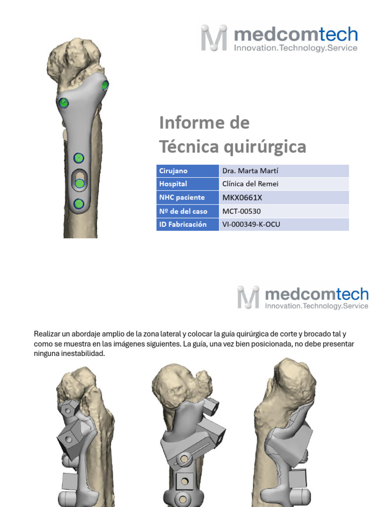 MCT-00530 - Técnica Quirúrgica | PDF | Tornillo