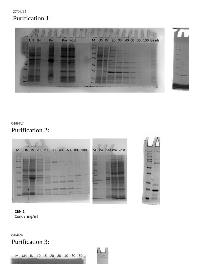 Protein Purification | PDF | Laboratory Techniques | Laboratories