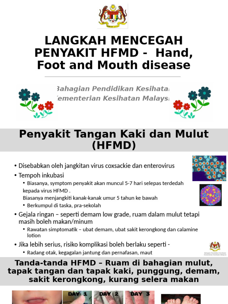 HFMD KKM Slides - Edited | PDF