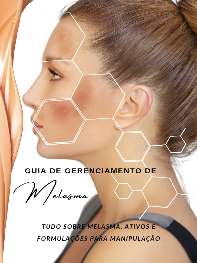 Tudo sobre Melasma, tratamentos e fórmulas | PDF | Ultravioleta | Protetor solar