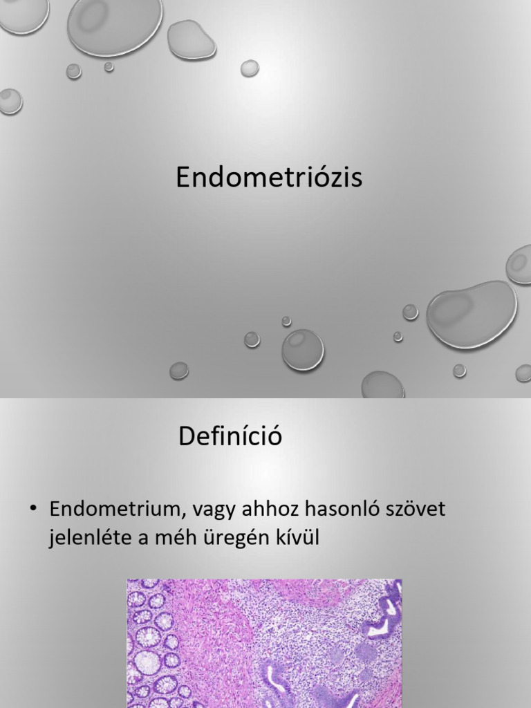 EndometriÃ Zis - 2024 | PDF