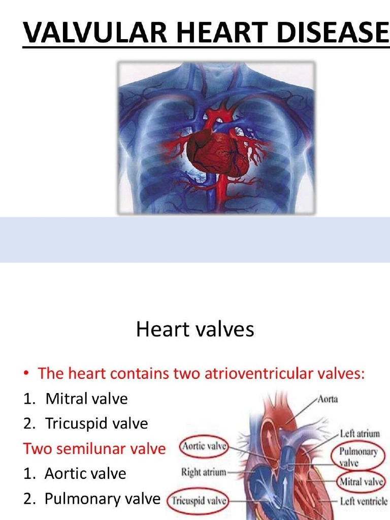 Valvular Heart Diseases | PDF