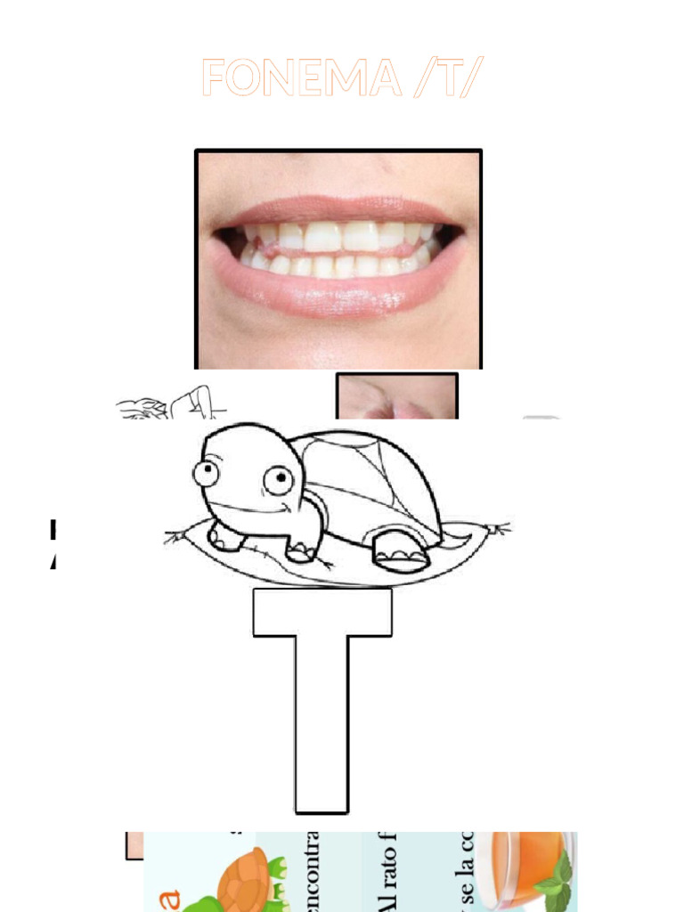 Fonema /t/: Articulación y características | PDF