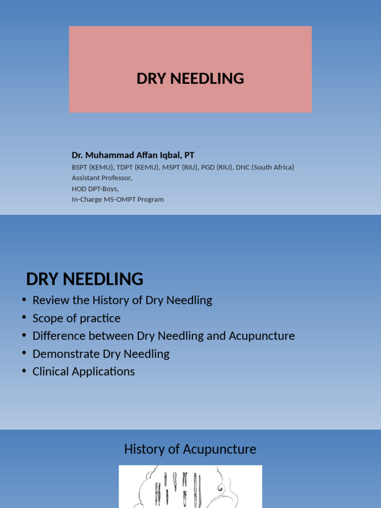 Lecture No. 04. Dry Needling | PDF | Arm | Elbow