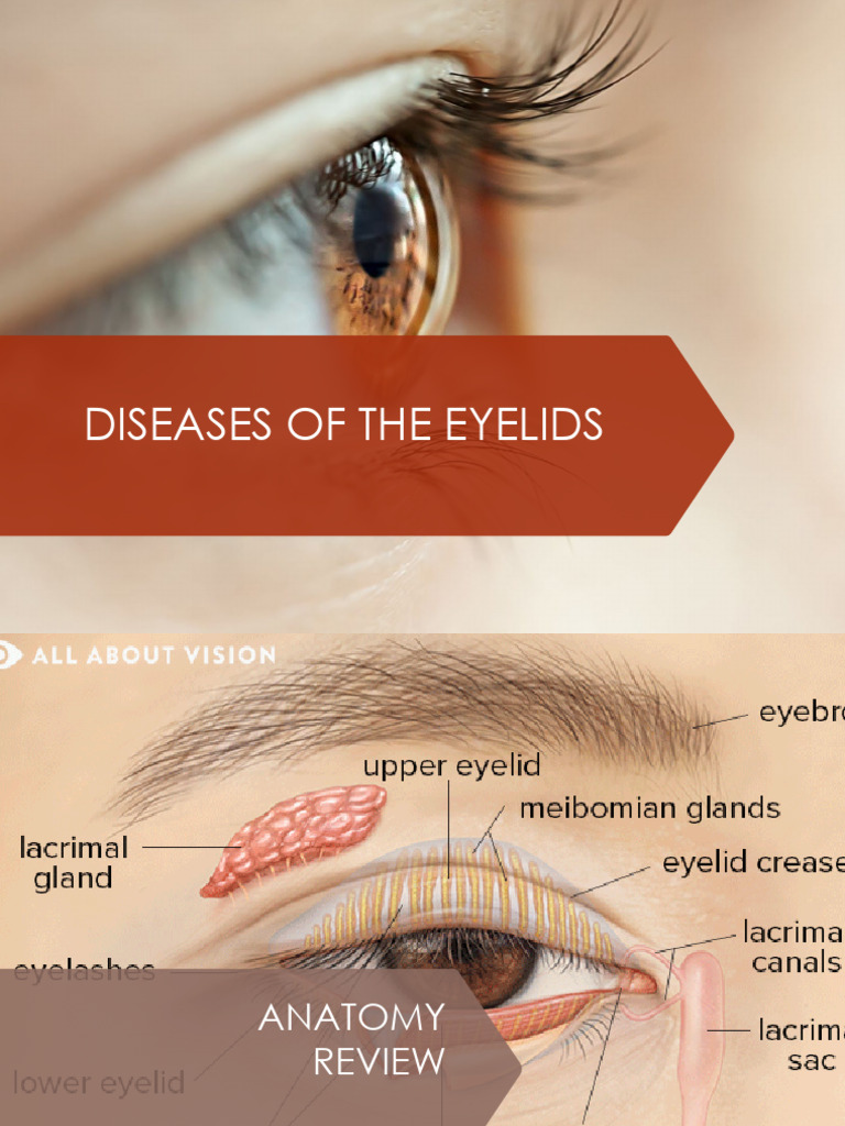 02 Diseases of The Eye Lids | PDF | Human Eye | Ophthalmology