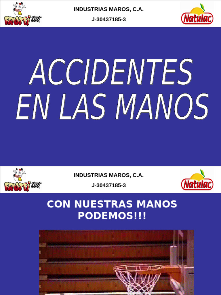 Accidentes de Las Manos | PDF