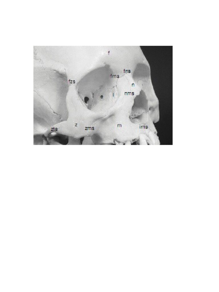 Skull Sutures Overview: Lambdoid Focus | PDF