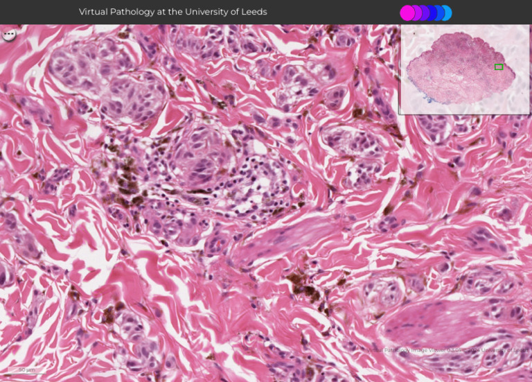 Slide Viewer Virtual Pathology at The University of Leeds 3 | PDF