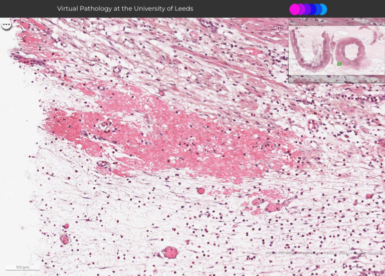 Slide Viewer Virtual Pathology at The University of Leeds | PDF