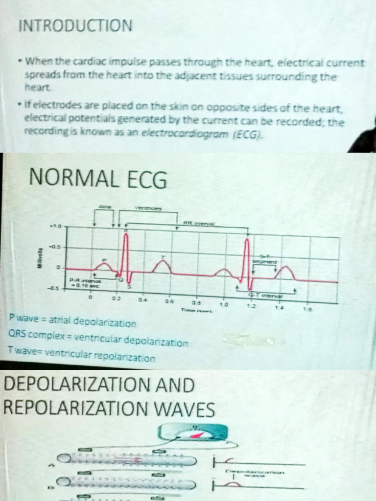Lec5 ECG 2 Normal ECG Pattern | PDF