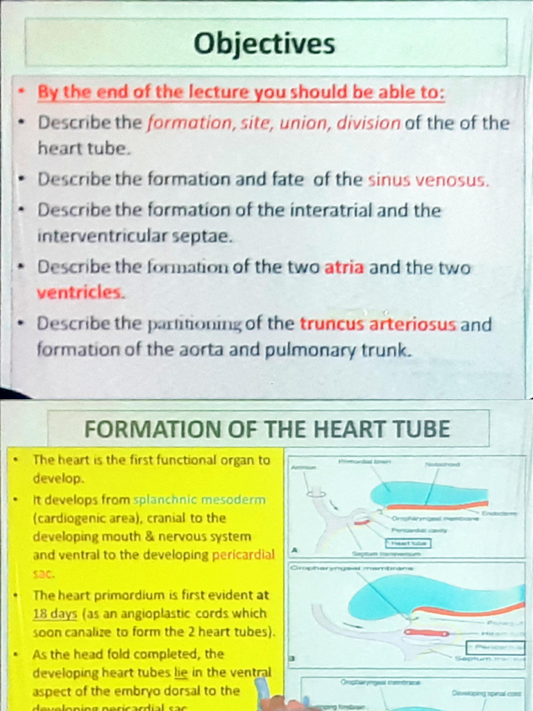 Lec1 Development of Heart | PDF