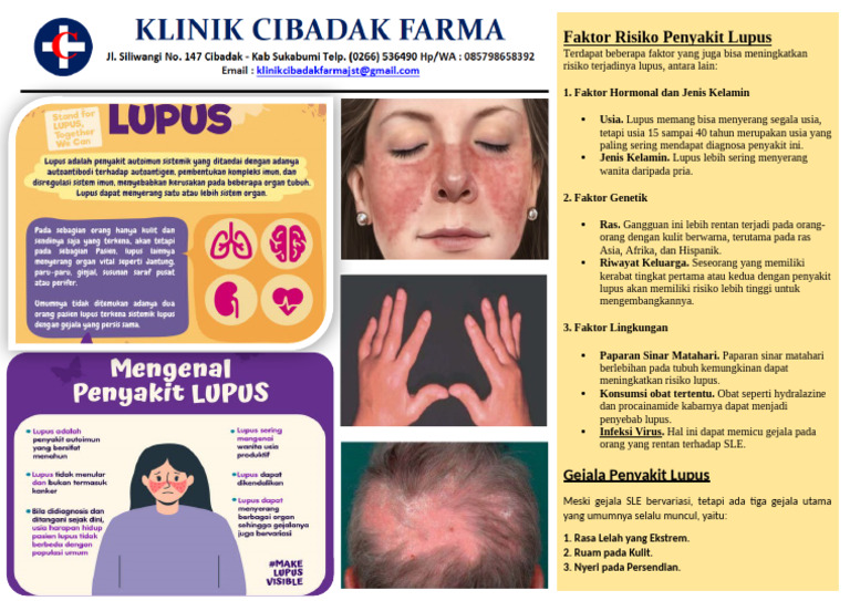 Leaflet Lupus BLN September 2024 | PDF | Kesehatan Holistik | Sains & Matematika