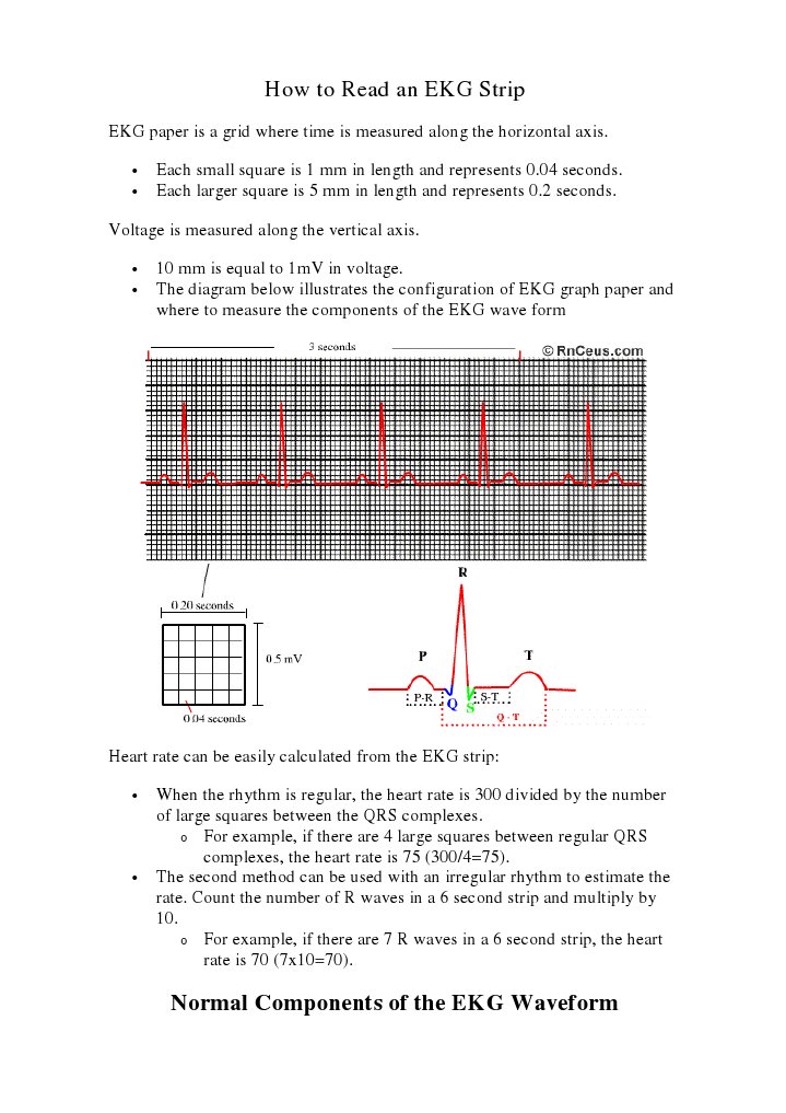How To Read An EKG Strip | PDF | Electrocardiography | Cardiac Arrhythmia