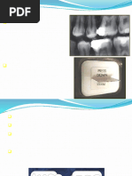 The Procedure Note - Laceration Repair | PDF | Wound | Surgical Suture