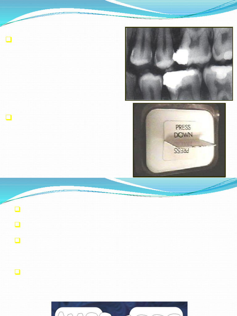 Pediatric Occlusal Projection Techniques | PDF | Dental Anatomy | Mouth