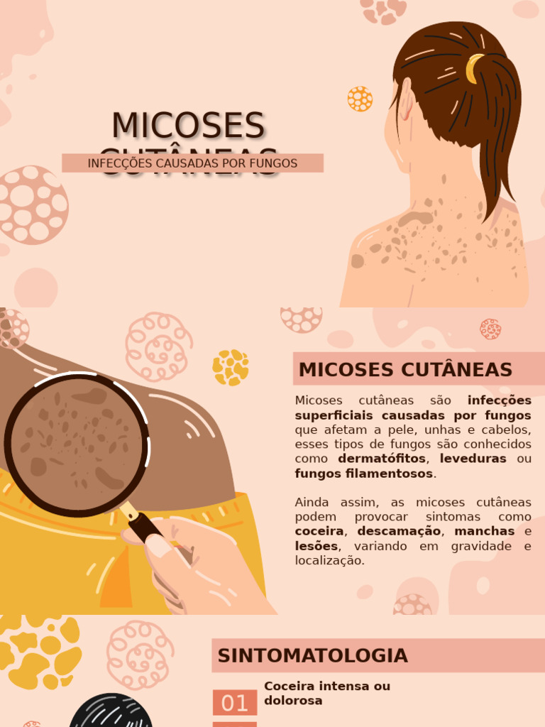 Micoses Cutâneas - Apresentação de Microbiologia | PDF | Micologia ...