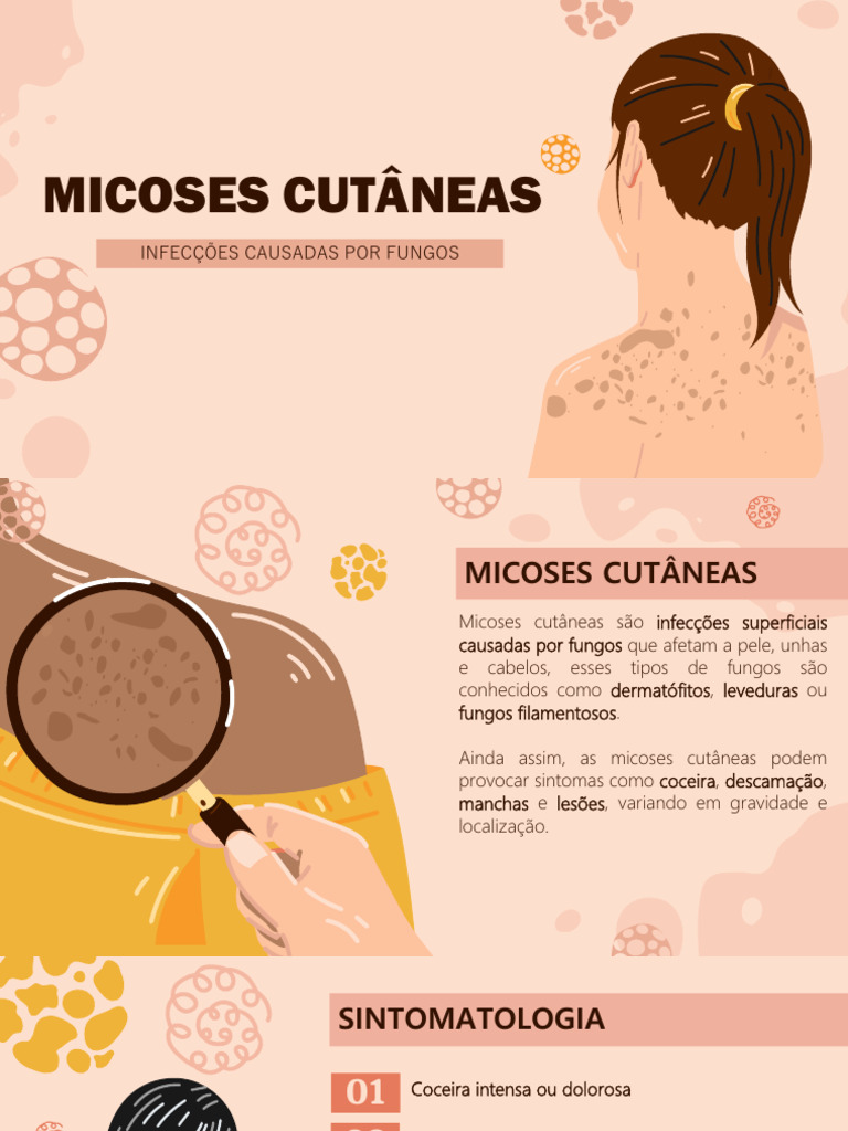 Micoses Cutâneas: Sintomas e Tipos | PDF | Micologia | Dermatologia