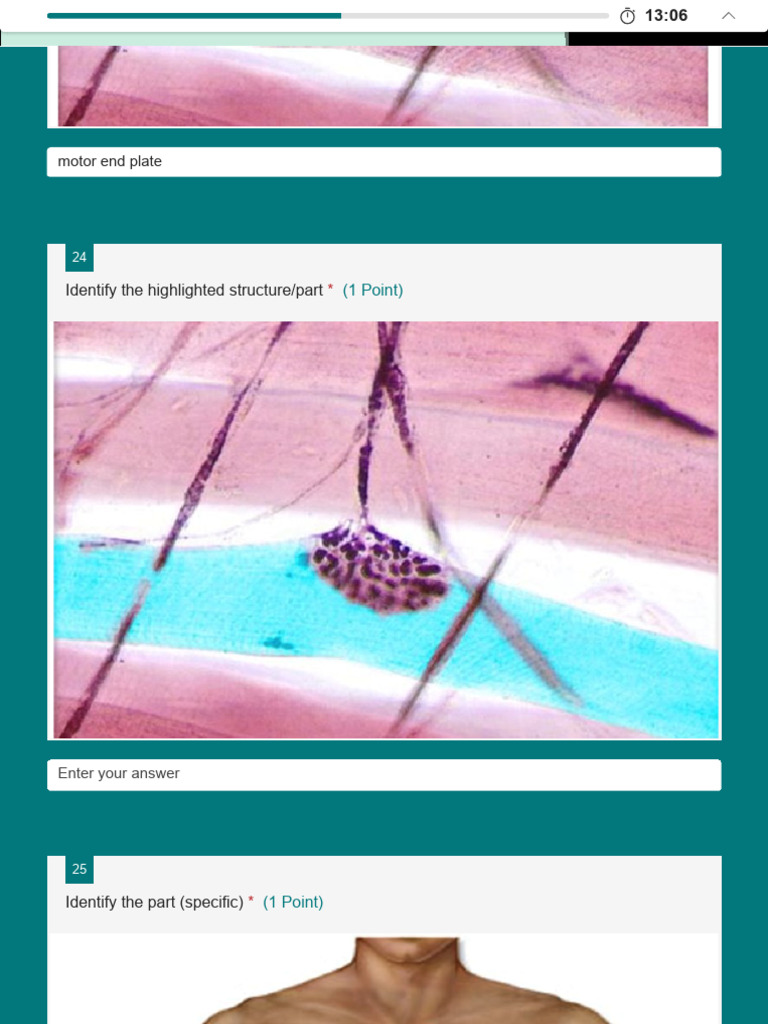 Quiz On Muscle & Nervous Tissues, and Body Membranes 5 | PDF