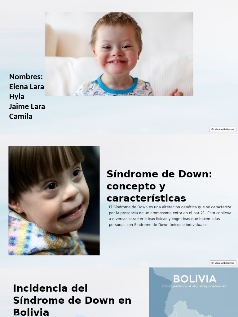 Sindrome de Down | PDF | Síndrome de Down | Aprendizaje