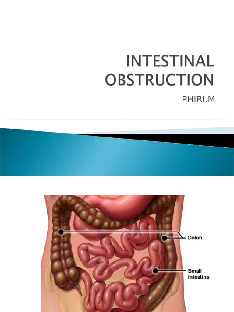 Intestinal Obstruction | PDF | Gastroenterology | Clinical Medicine