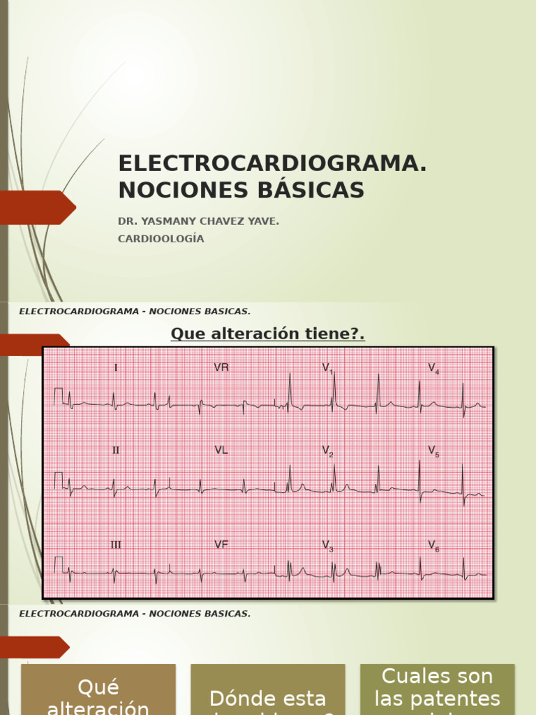 Guía Básica de Electrocardiograma | PDF | Electrocardiografia | Corazón